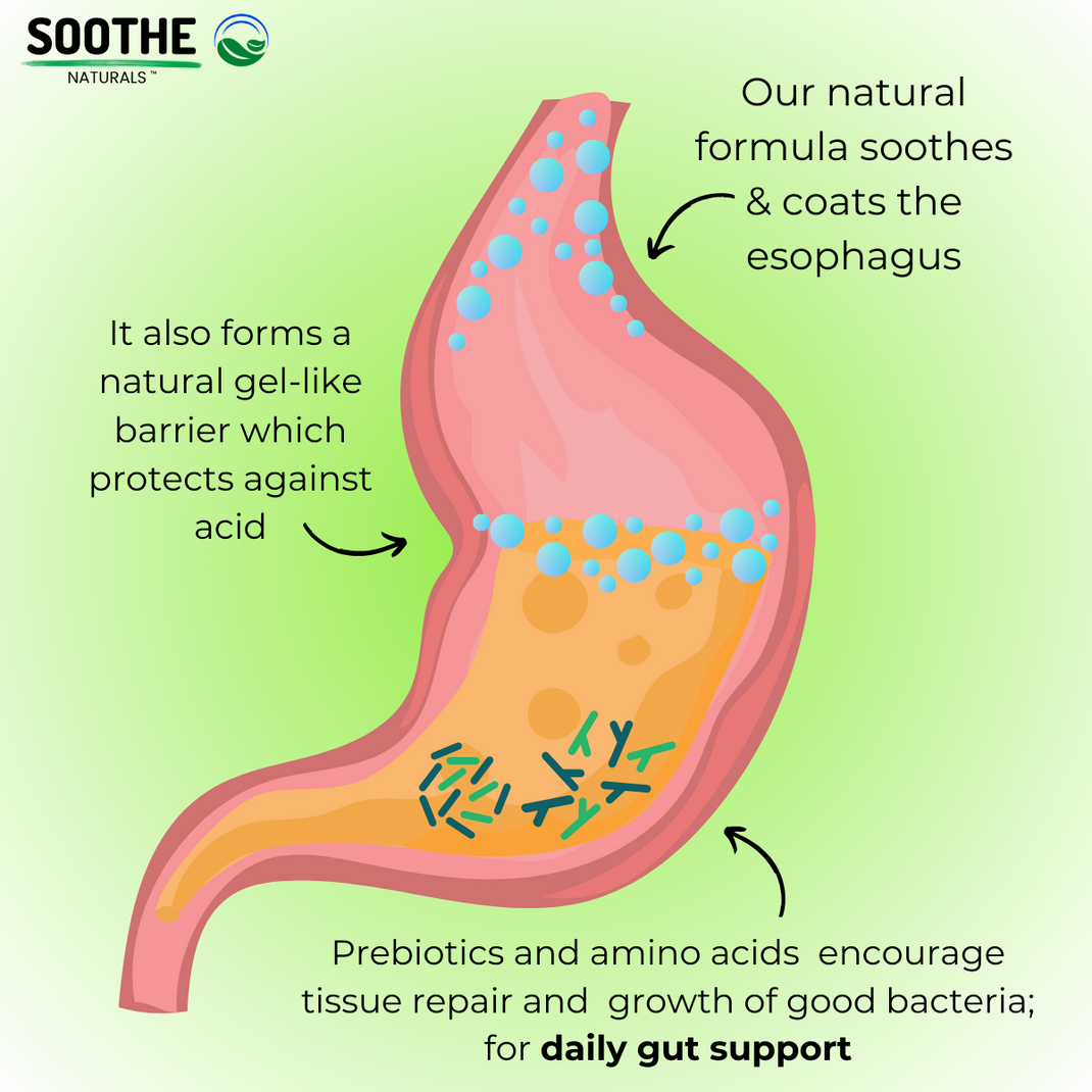 Stomach Soothe - Natural Heartburn Relief & Gut Support – Soothe Naturals